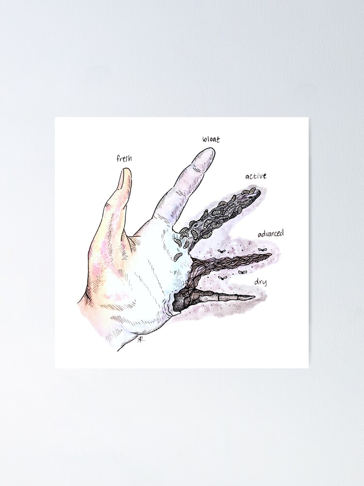 "Stages of Decay Hand by Skye Rain Art" Poster for Sale by Skye Rain ...