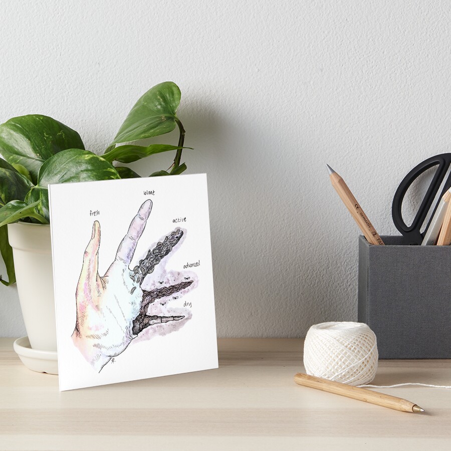 "Stages of Decay Hand by Skye Rain Art" Poster for Sale by Skye Rain ...