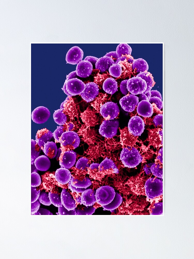 "Staphylococcus Epidermidis Bacteria, SEM" Poster for Sale by ...