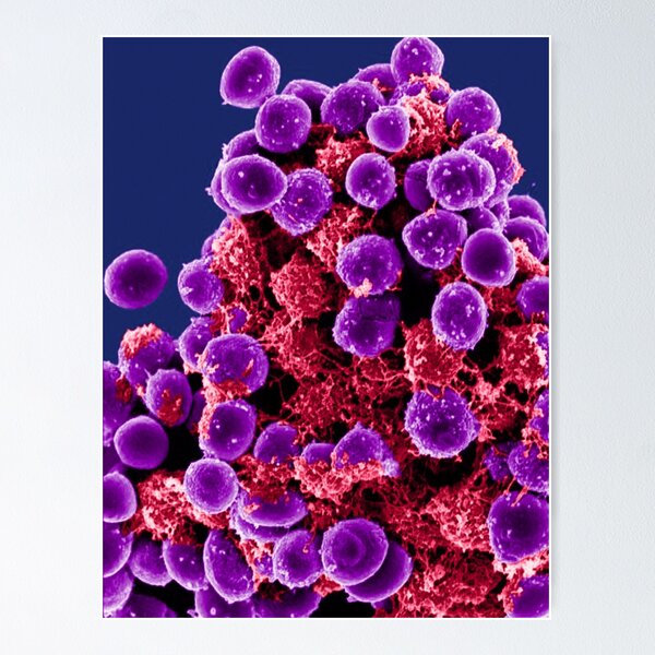 "Staphylococcus Epidermidis Bacteria, SEM" Poster for Sale by ...