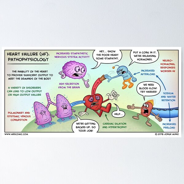 "Heart Failure: Pathophysiology" Poster for Sale by Medcomic | Redbubble