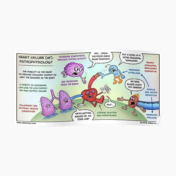 "Heart Failure: Pathophysiology" Poster for Sale by Medcomic | Redbubble