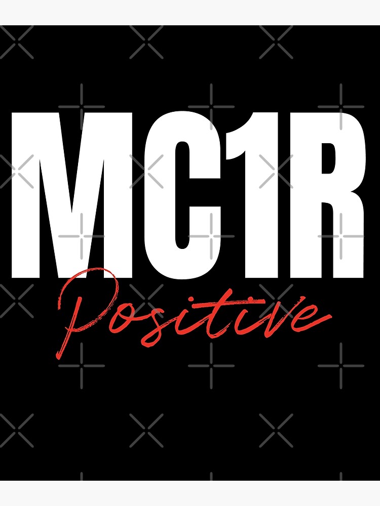 "MC1R Positive Redhead Red Hair" Photographic Print by mooon85 | Redbubble