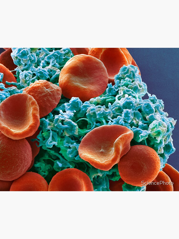 "Red blood cells and platelets, SEM (C029/3211)" Sticker for Sale by ...