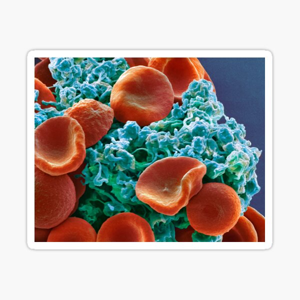 "Red blood cells and platelets, SEM (C029/3211)" Sticker for Sale by ...