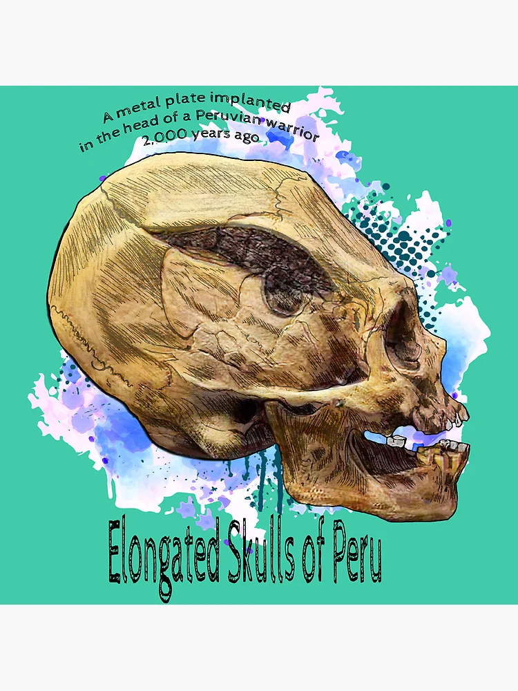 Elongated Skulls Nephilim