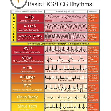 "Ecg Ekg basics Knowledge " Metal Print for Sale by Weird-Artss | Redbubble