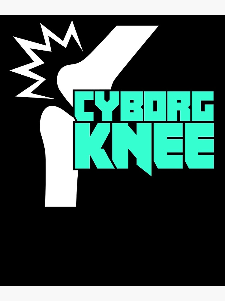 Lámina fotográfica «Cyborg Knee | Cirugía de reemplazo de articulación ...