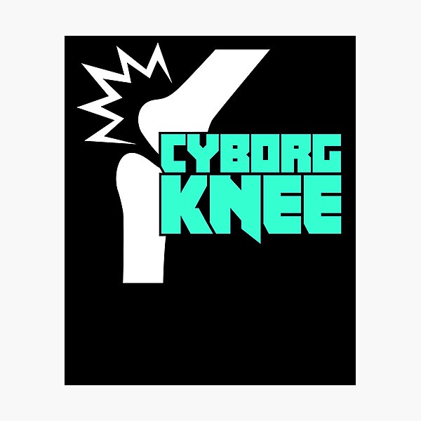 Lámina fotográfica «Cyborg Knee | Cirugía de reemplazo de articulación ...