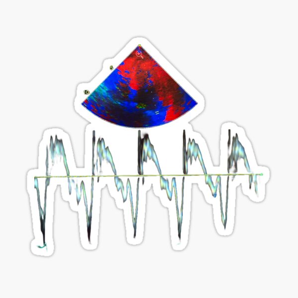 "Echocardiogram doppler map and waveform tracing" Sticker for Sale by ...