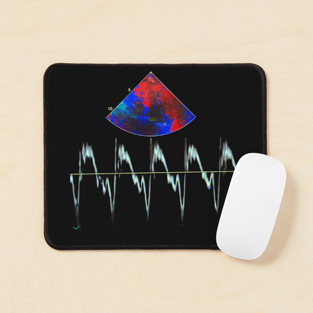 "Echocardiogram doppler map and waveform tracing" Sticker for Sale by ...