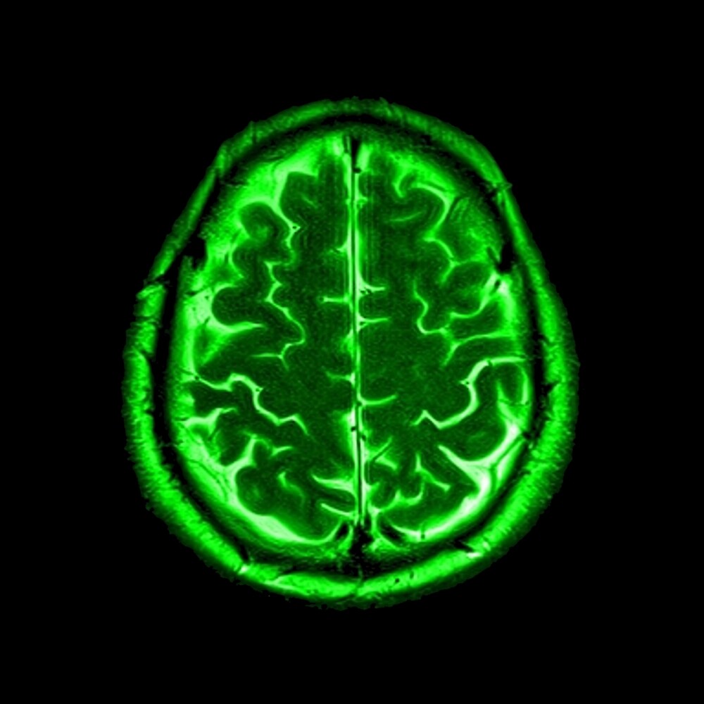 "Xray green brain" by Campre | Redbubble