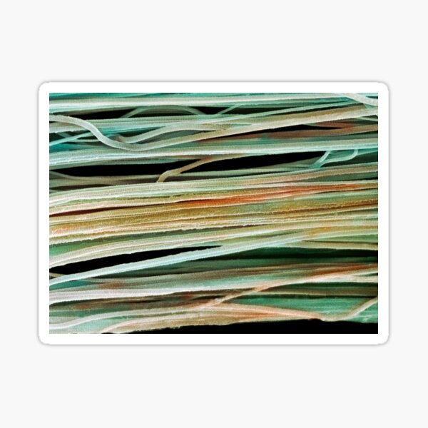 Tendon Gifts & Merchandise for Sale | Redbubble