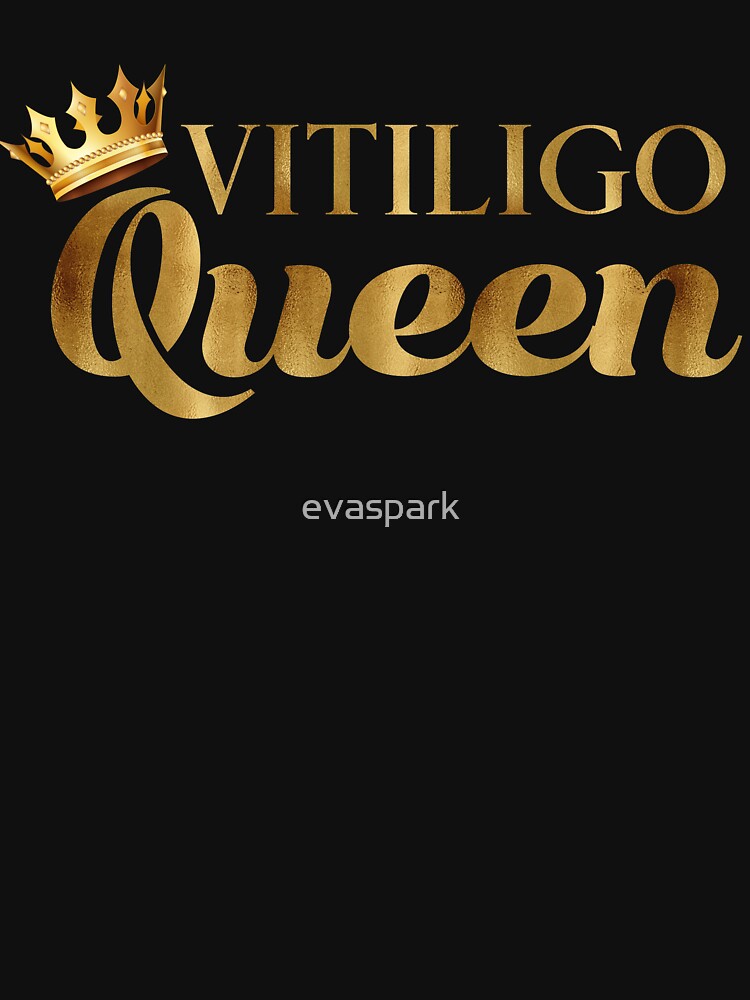 Vitiligo Queen T Shirt Vitiligo Awareness T Shirt By Evaspark