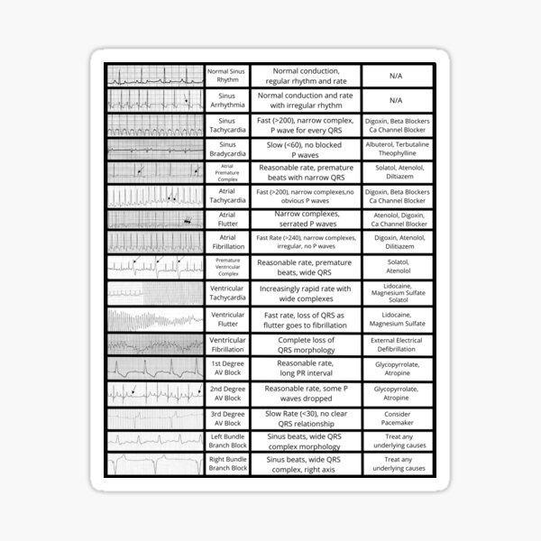 "Small Animal ECG Chart " Sticker for Sale by Katherine Adwell | Redbubble