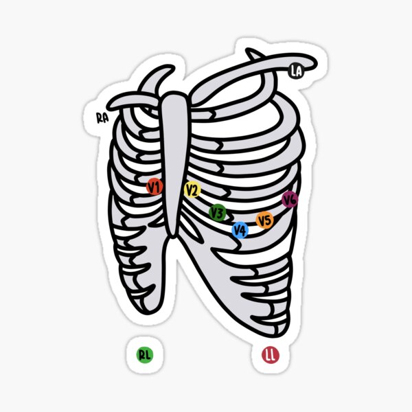 "Hand Drawn 12 Lead Electrocardiogram (ECG) Pastel" Sticker for Sale by ...