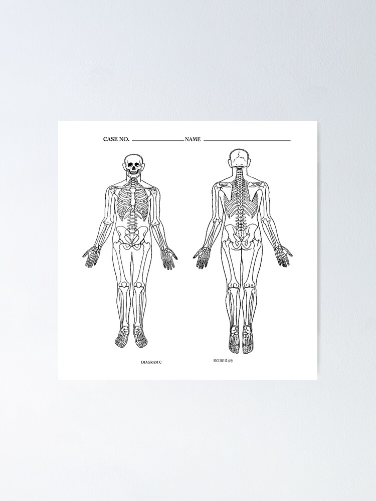 "Blank Autopsy Diagram, Skeleton, anterior and posterior" Poster for ...