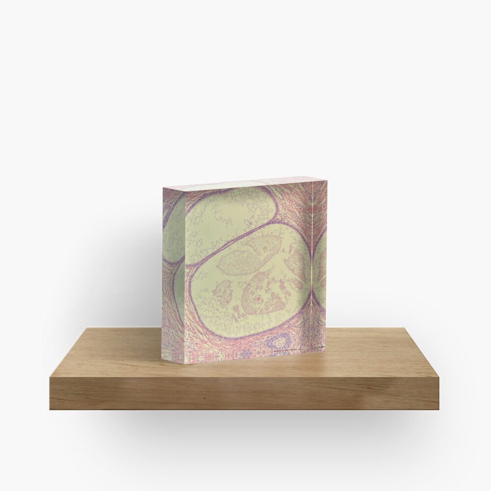 "Prostate glands under the microscope - histology" Sticker for Sale by ...