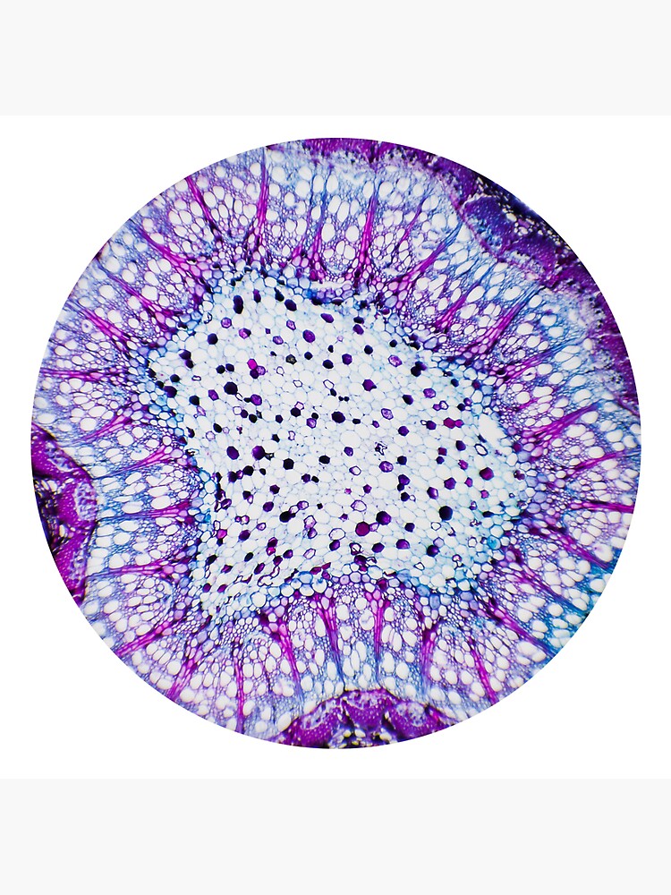 "Lenticel - Plant Stem Tissue - Microscopy Photograph" Sticker by ...