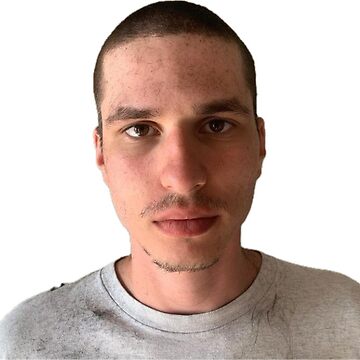 "bald martin slushy noobz" Sticker for Sale by slurpeeproz | Redbubble