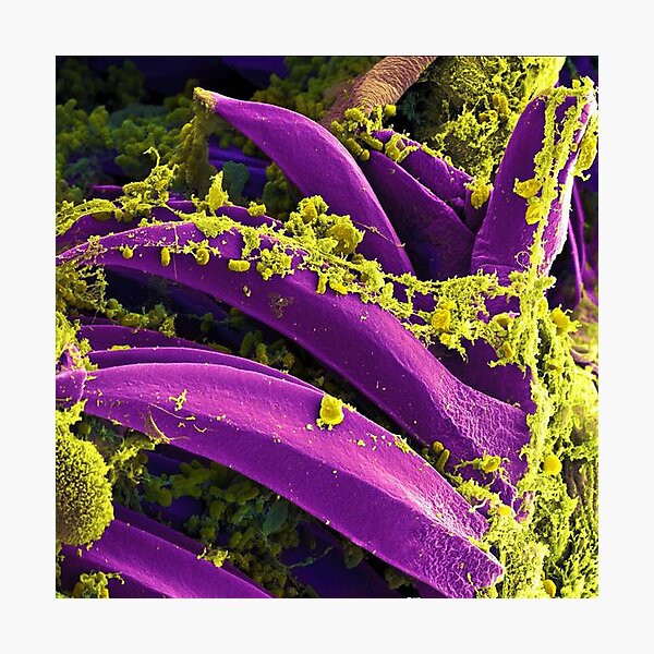Pathogen Wall Art | Redbubble