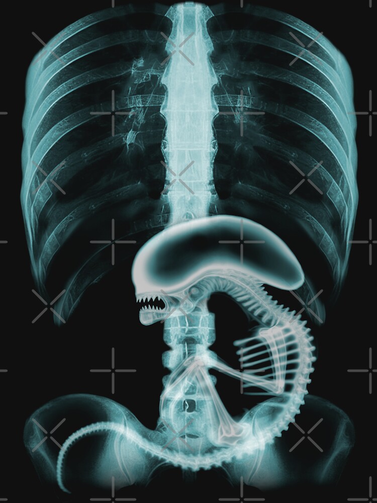 "Alien radiography v2, Alien X-ray v2, blue" Essential T-Shirt by ...