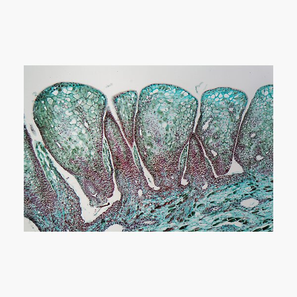 "Detail of a female pine cone under the microscope." Photographic Print ...