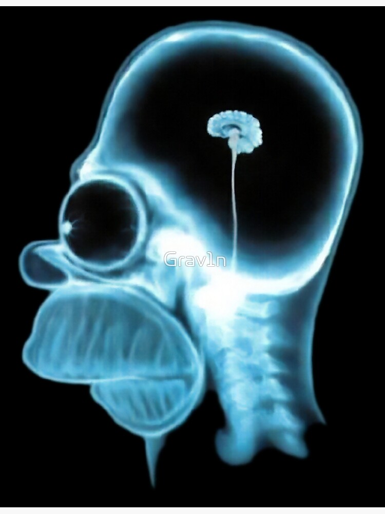 "Homer x-ray" Poster for Sale by Grav1n | Redbubble