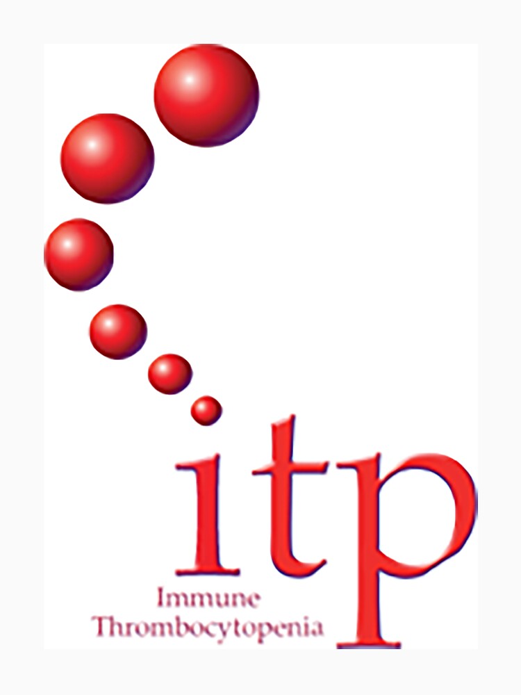 "Retro ITP UK and Ireland Logo" Essential T-Shirt for Sale by ...