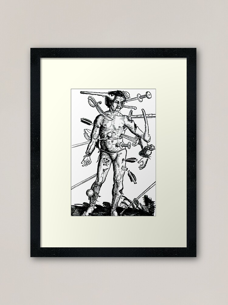 "Wounded Man" Framed Art Print for Sale by ScienceSource | Redbubble