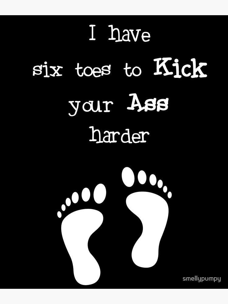 "Foot Six Toes Polydactyly" Art Print by smellypumpy | Redbubble