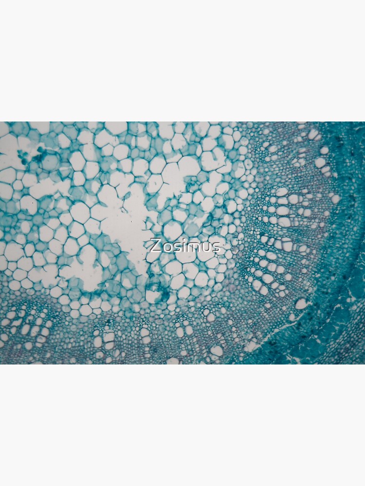 Stem cells of a lentil plant under the microscope. Premium Matte ...