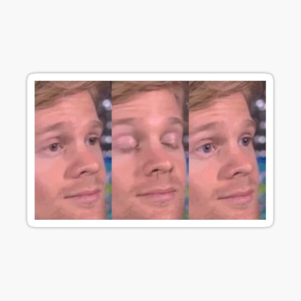 "White guy blinking" Sticker by SpaceNoise | Redbubble