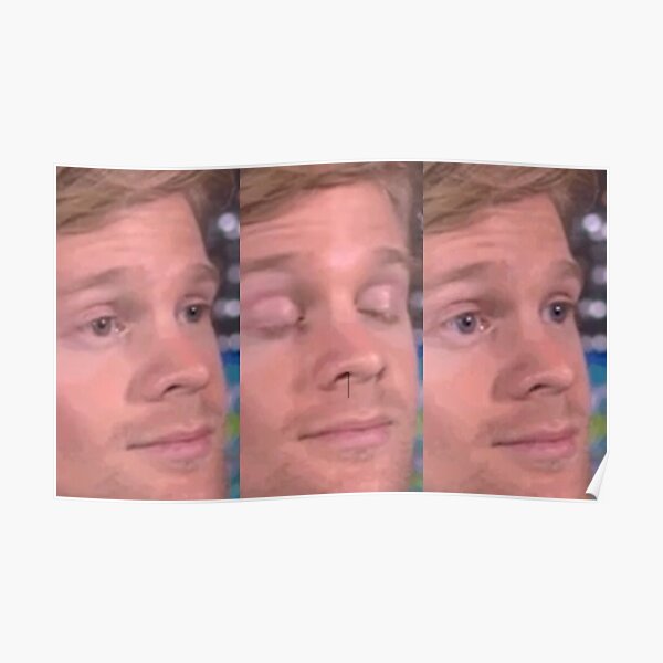 "White guy blinking" Poster by SpaceNoise | Redbubble