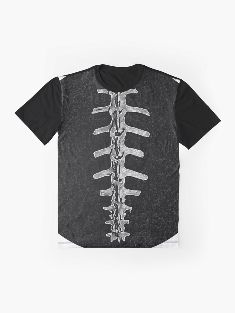 "X-ray Spine." Graphic T-Shirt for Sale by Artroomstudio | Redbubble