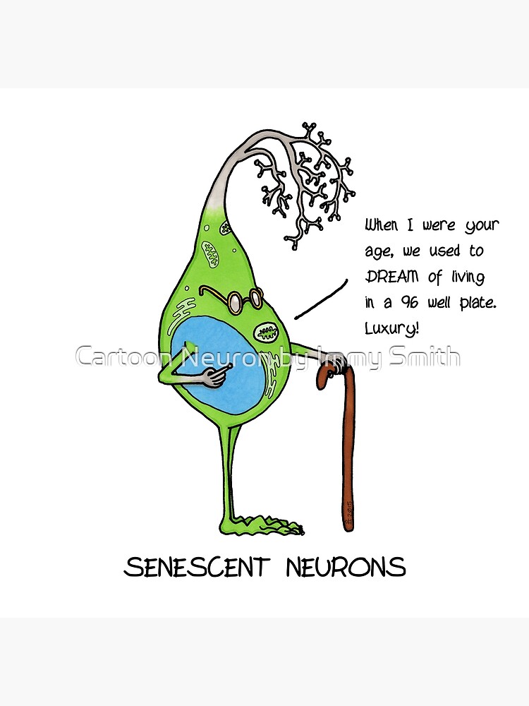 "Cell Culture Problems: Senescent Neurons" Art Board Print for Sale by ...