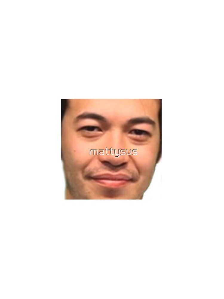 "WeirdChamp Twitch Emote" iPhone Case for Sale by mattysus | Redbubble