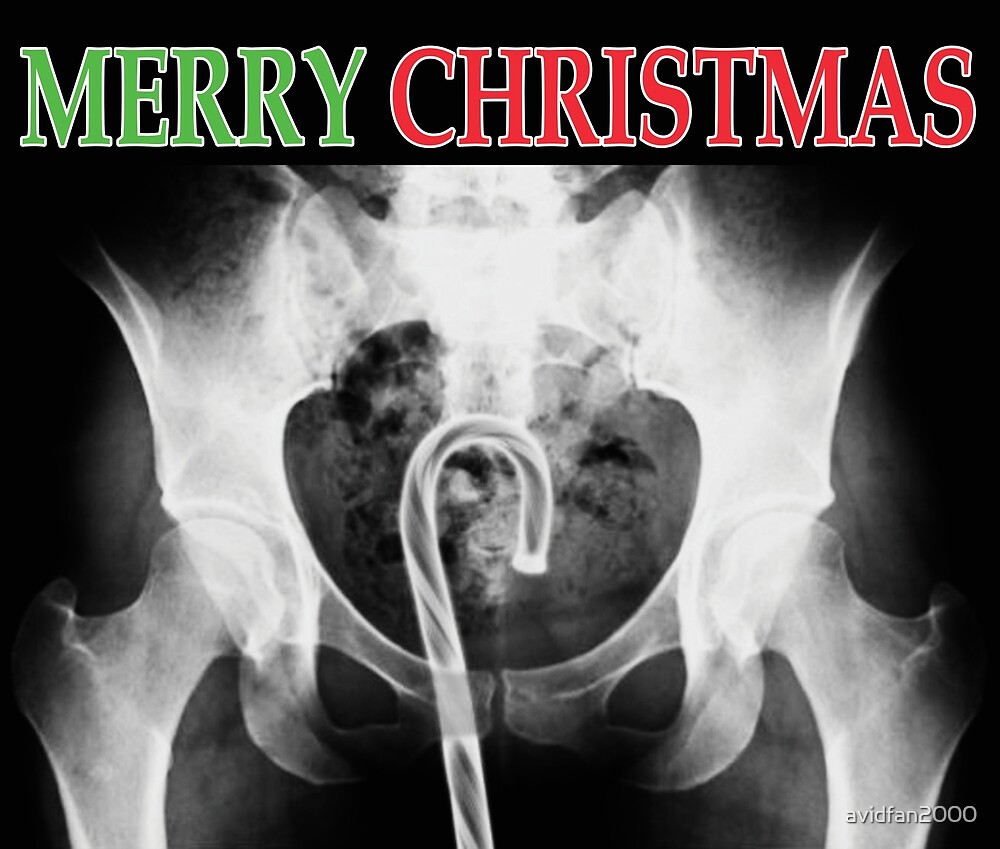 "X-Ray Merry Christmas Candy Cane" by avidfan2000 | Redbubble