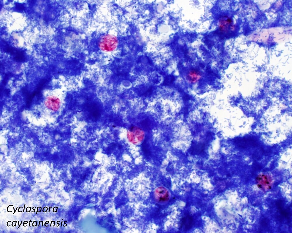 "Cyclospora cayetanensis - an intestinal parasite" by Bobbi Pritt ...