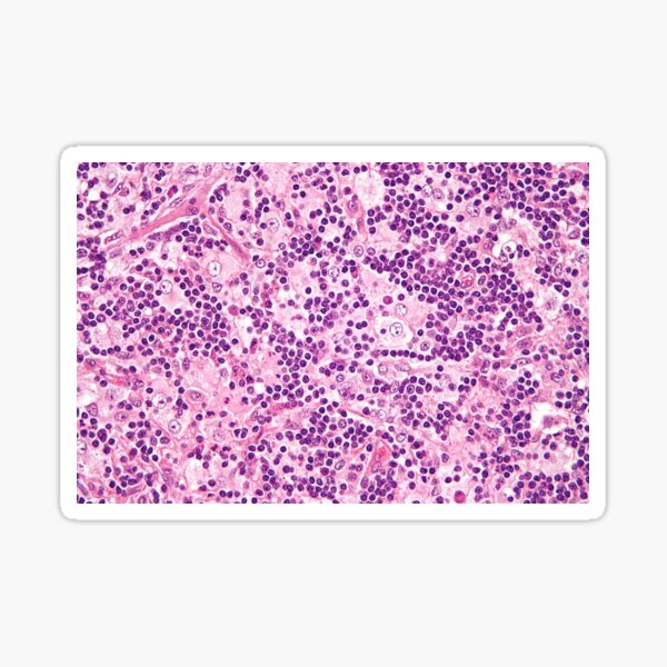 "Lymph Node Histology" Sticker for Sale by deltoid | Redbubble
