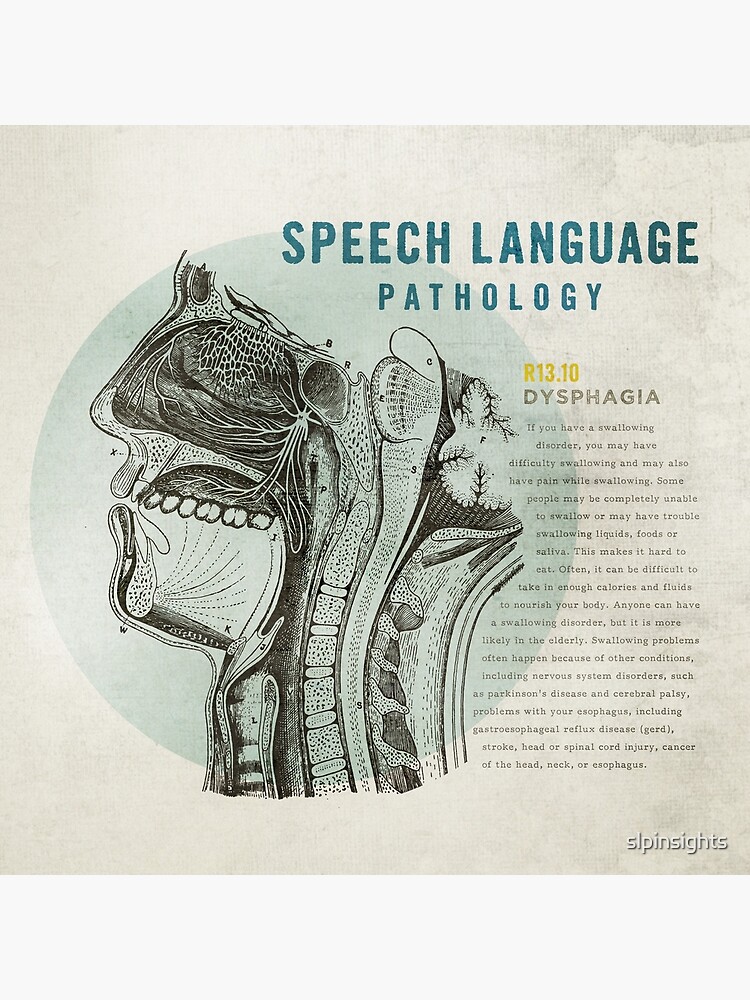 "SLP Dysphagia" Art Print for Sale by slpinsights | Redbubble