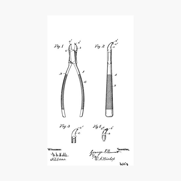 "Dental Forceps Vintage Patent Hand Drawing" Photographic Print for ...