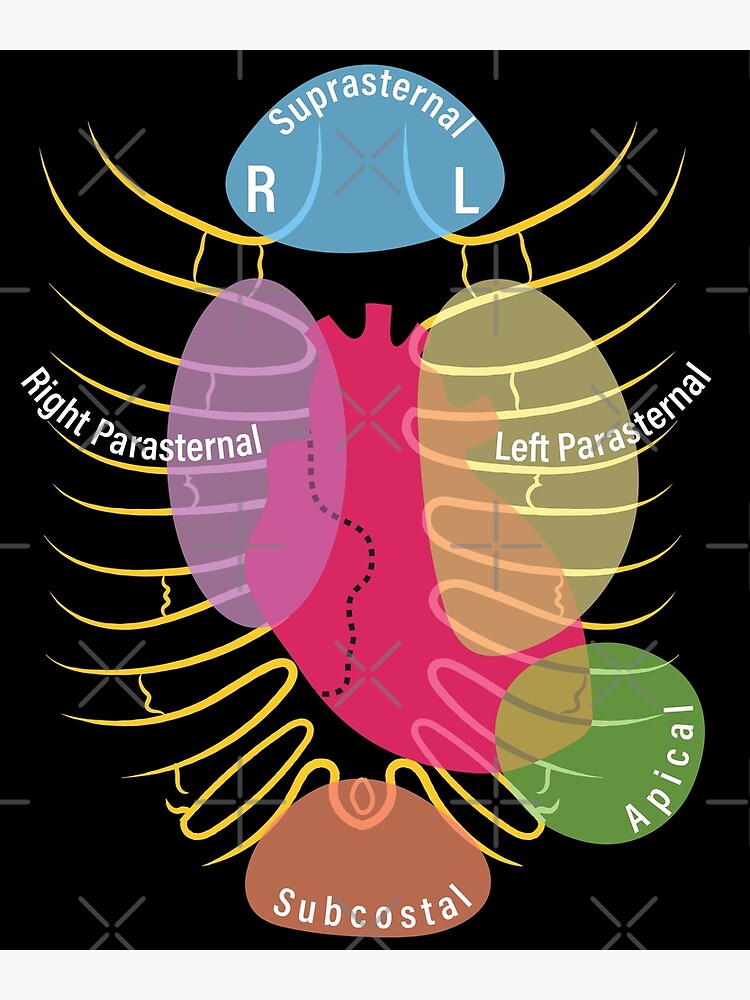 Echocardiography Cardiac Acoustic Windows Premium Matte Vertical Poster ...