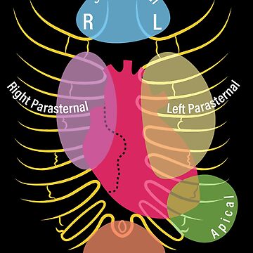 "Echocardiography Cardiac Acoustic Windows " Poster for Sale by ...
