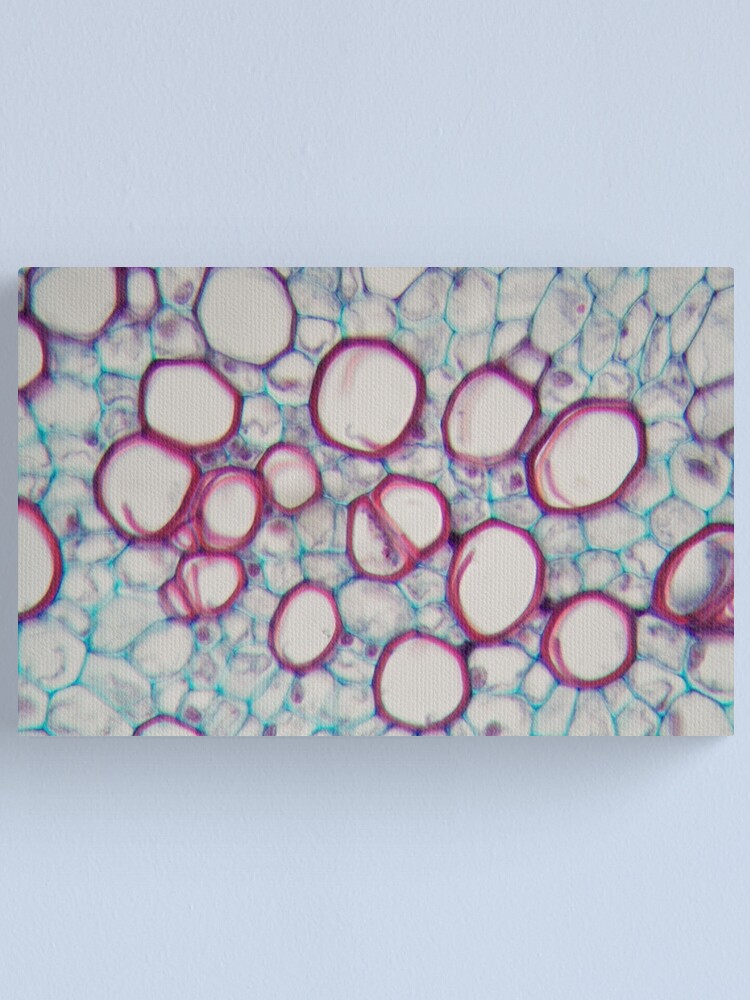 Parenchyma Tissue Under The Microscope 42 Sclerenchyma Cells Stock