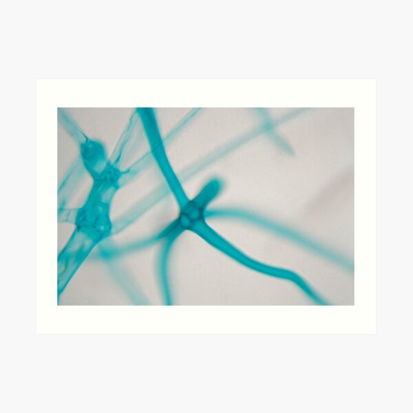 "Blue colored leaf hairs of a mullein plant (Verbascum) under the ...