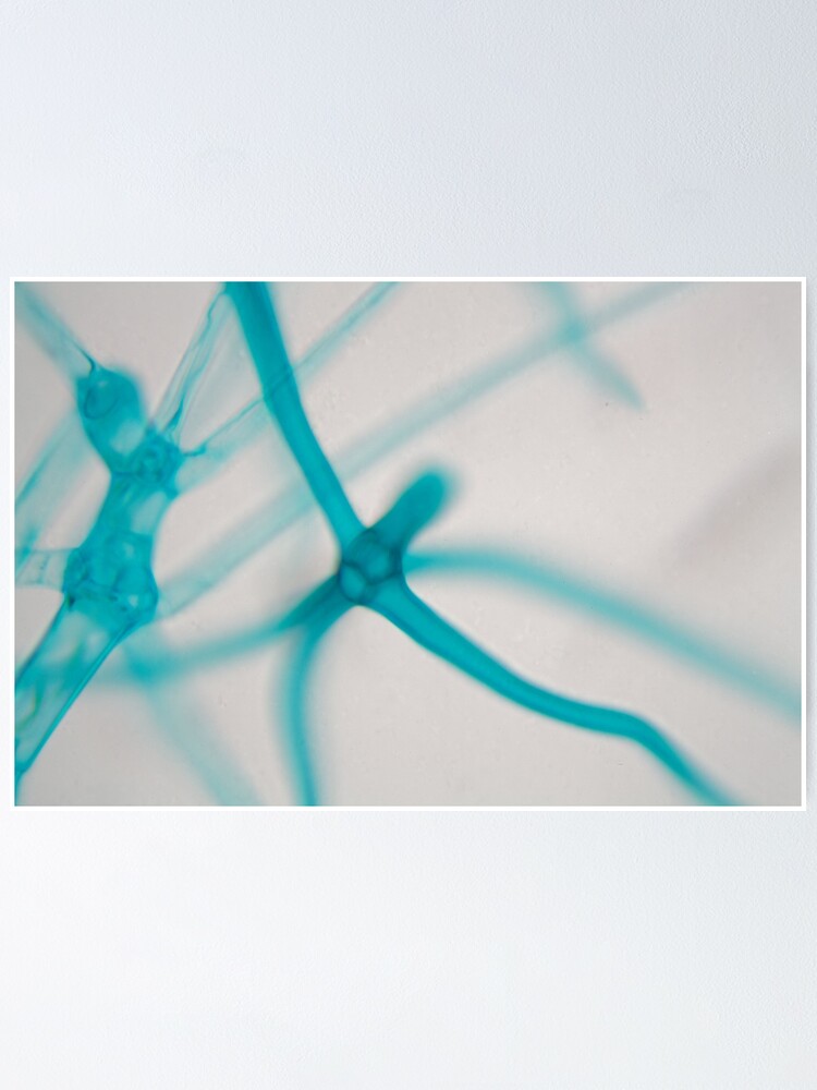 "Blue colored leaf hairs of a mullein plant (Verbascum) under the ...