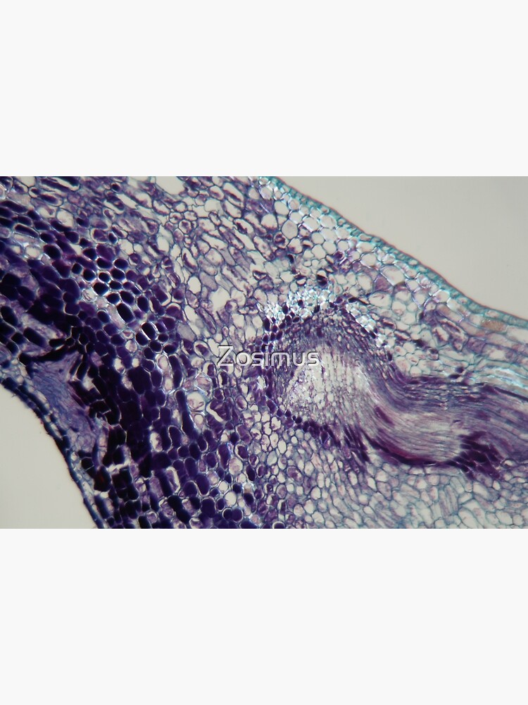 "Plant cells infected by a plant parasite under the microscope." Poster ...