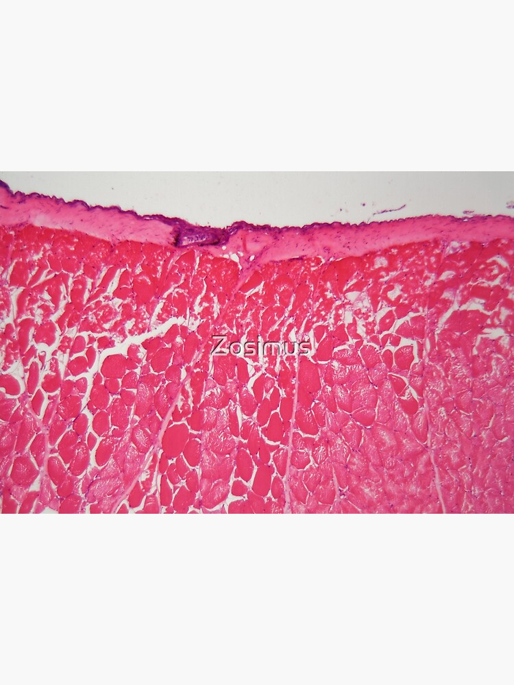 "Fish skin injured by chemicals under the microscope." Canvas Print by ...