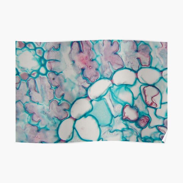 "Conifer needle cells with environmental damages under a microscope ...